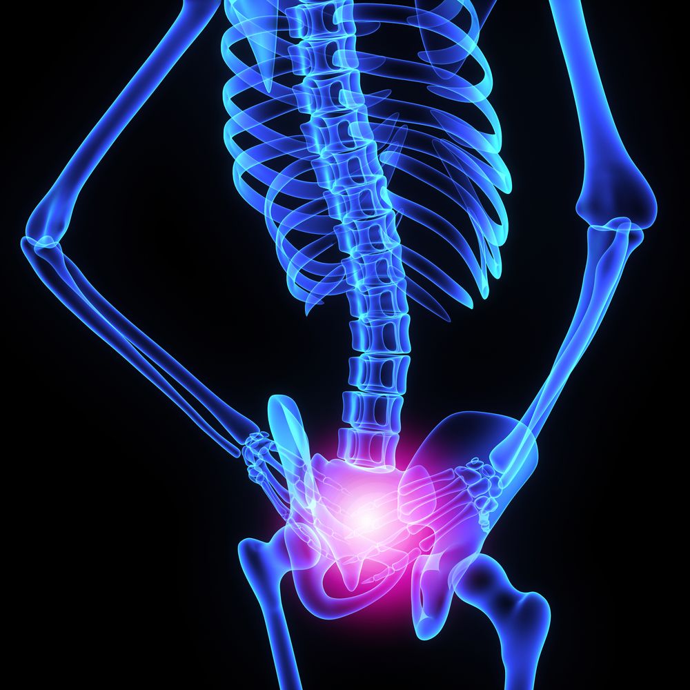 ASR Stem Revision Surgery Could Qualify You for Part of New Settlement ...