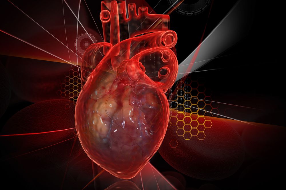 Consumer Claims IVC Gunther Tulip Filter Can Cause Serious ...