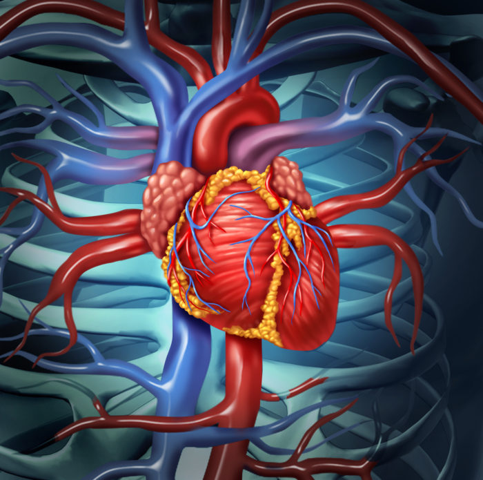 Study Analyzes Occurrence Rate of IVC Filter Perforation - Top Class ...