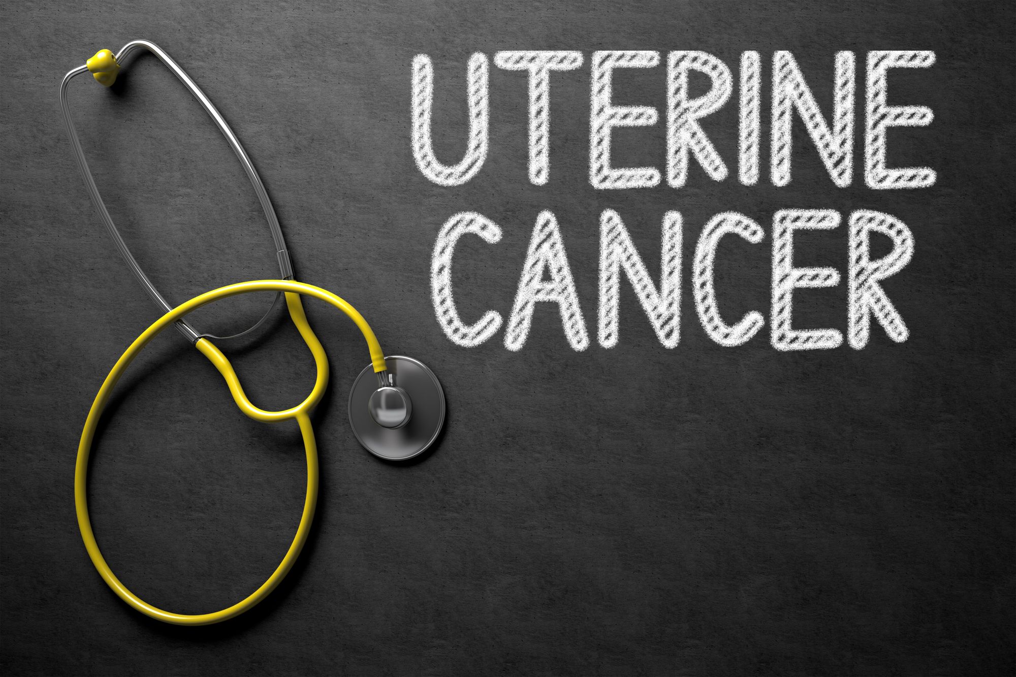 Upstaged Uterine Cancer Causes May Be Linked to Morcellation Surgery