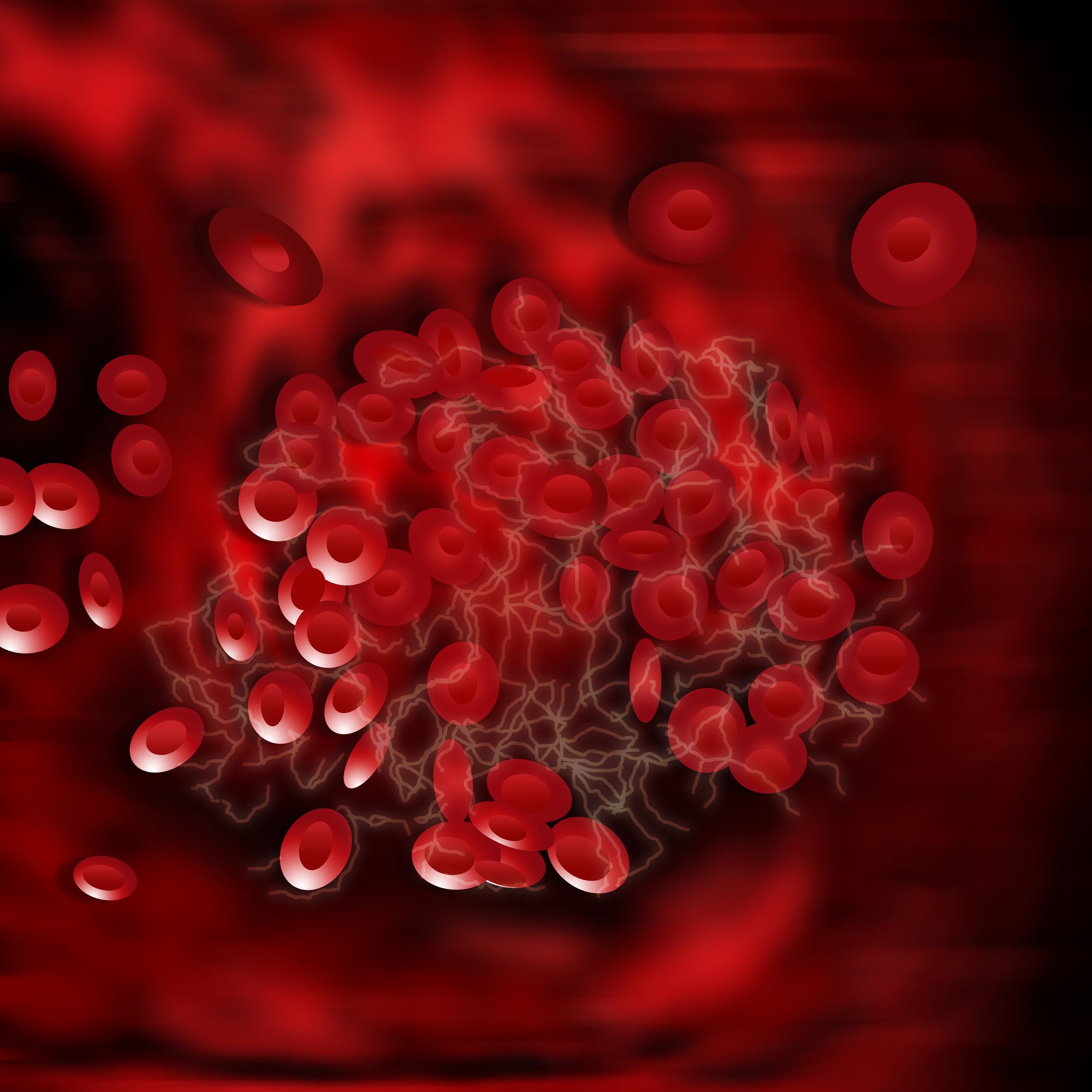 Vein Filter Adverse Side Effects May be Fatal