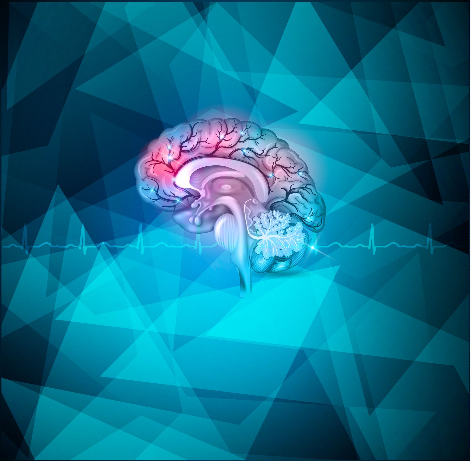 Cerebellar Atrophy's Link to Dilantin Neurological Side Effects - Top ...