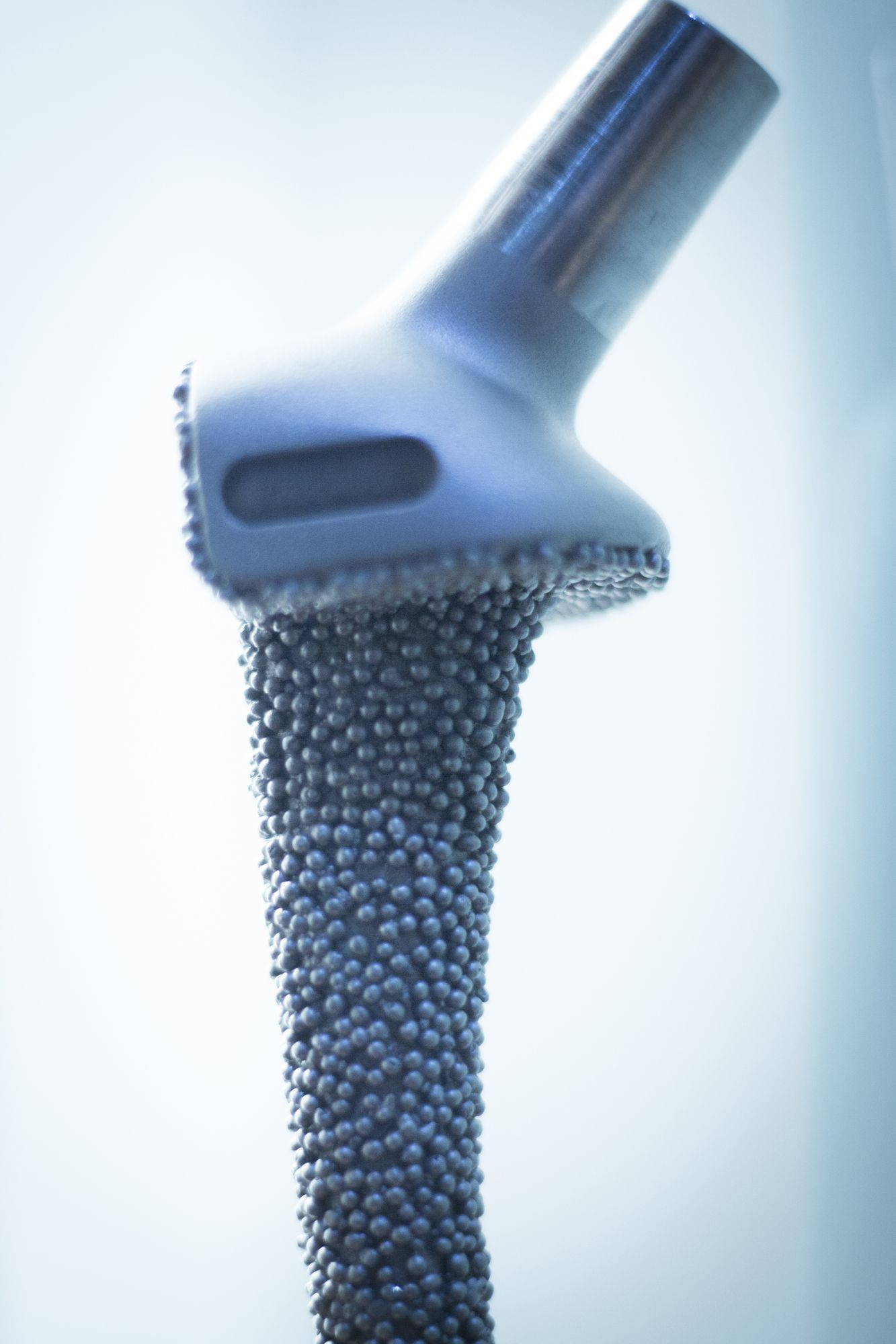 DePuy Pinnacle Hip Replacement Lawsuit Alleges Manufacturer Negligence ...