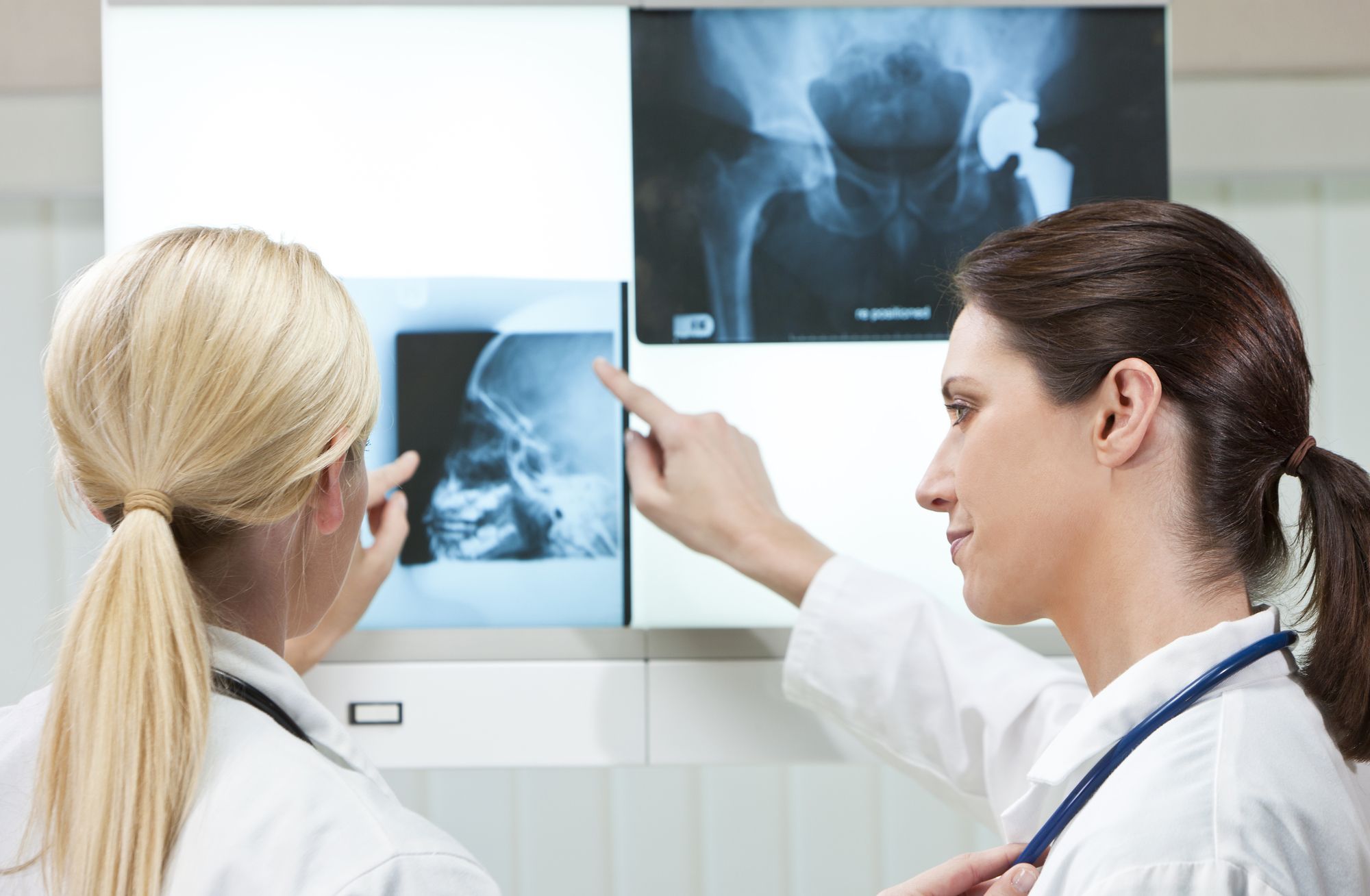 Woman Files DePuy Pinnacle Hip Lawsuit over Severe Adverse Side Effects ...