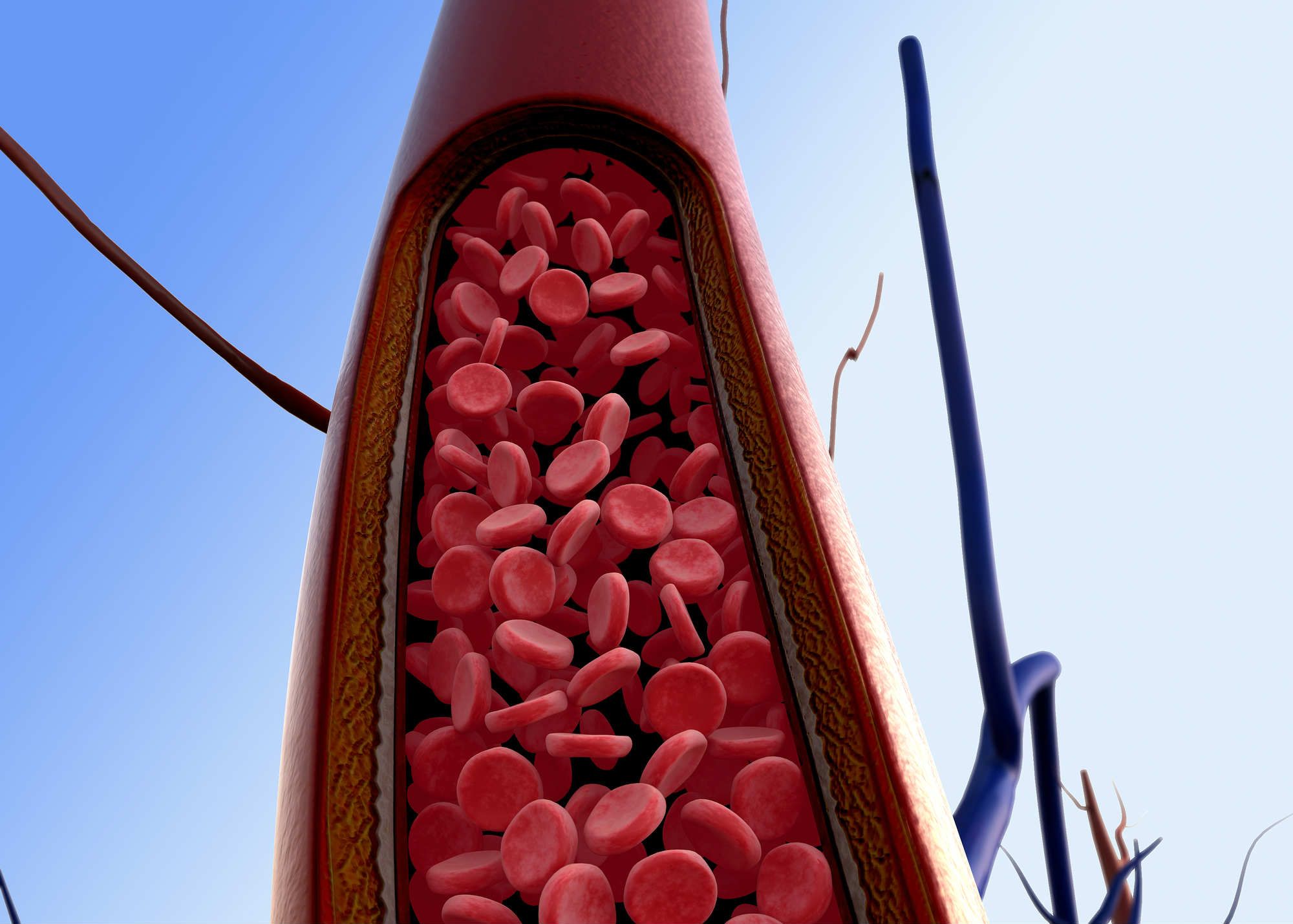 Bard Retrievable Clot Filter Allegedly Causes Severe Injuries to ...