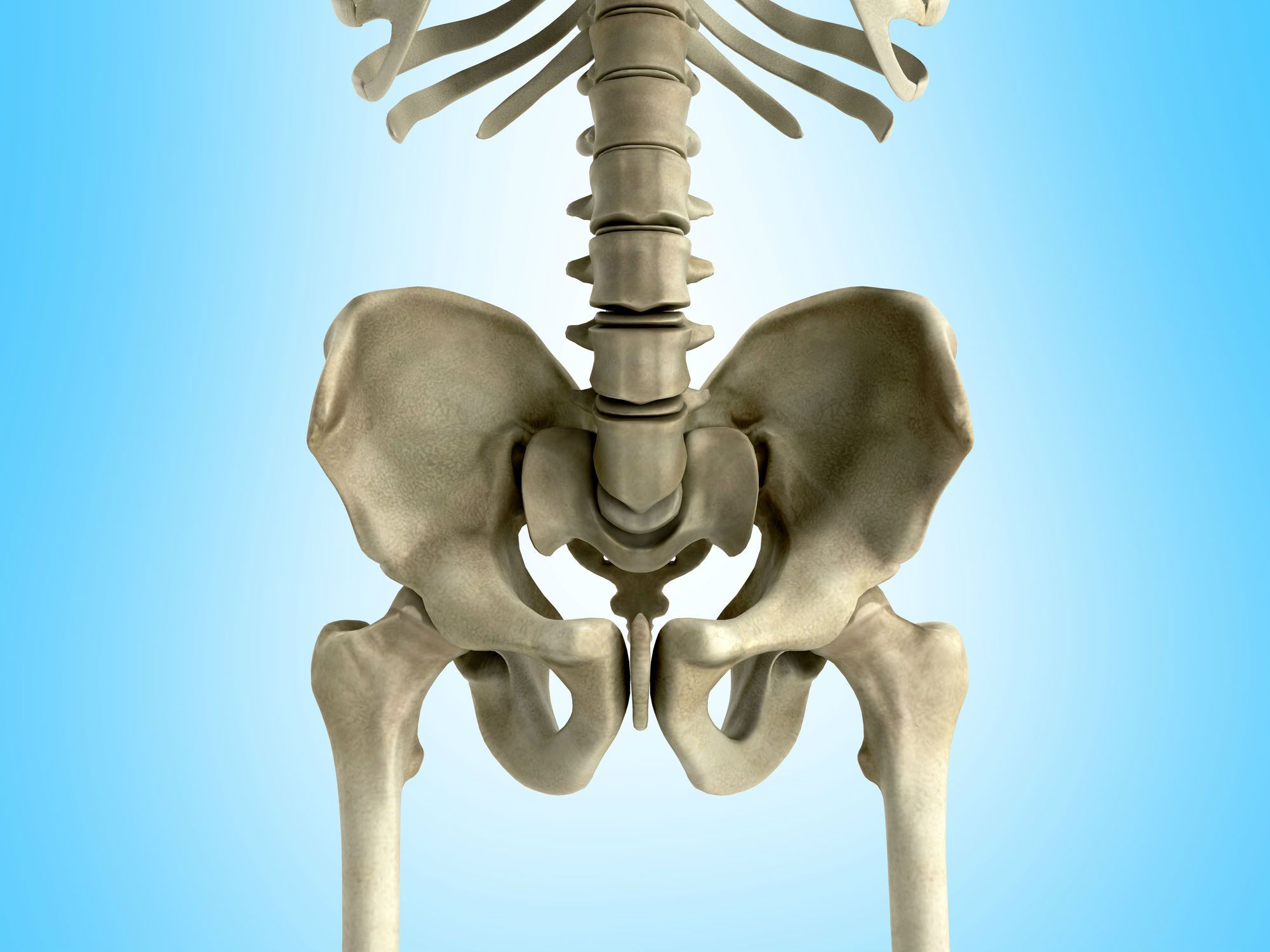 Failure of DePuy ASR Hip Replacement System Required Surgical Repair ...
