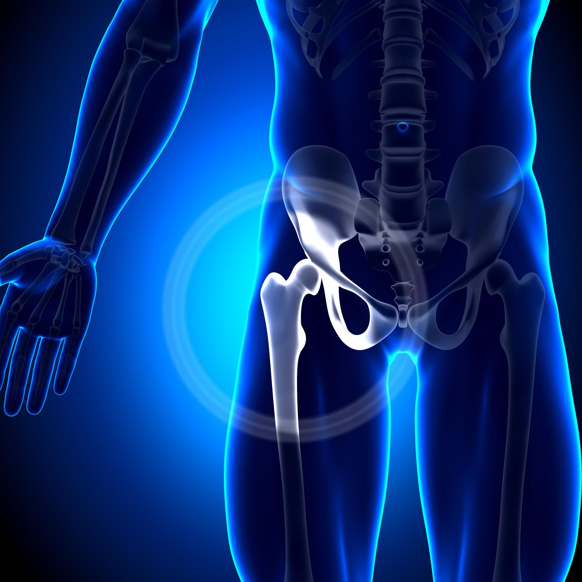 DePuy Pinnacle Lawsuit Alleges Defects Led to Revision Surgeries