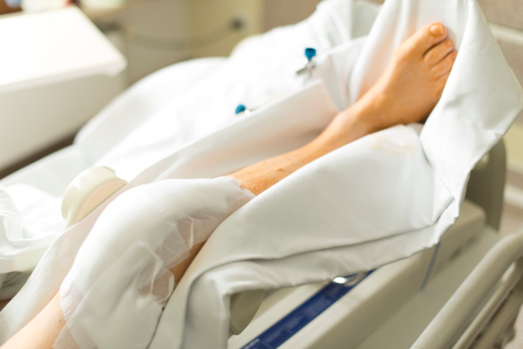 DePuy CMW-1 Bone Cement Blamed in Cases of Tibial Loosening