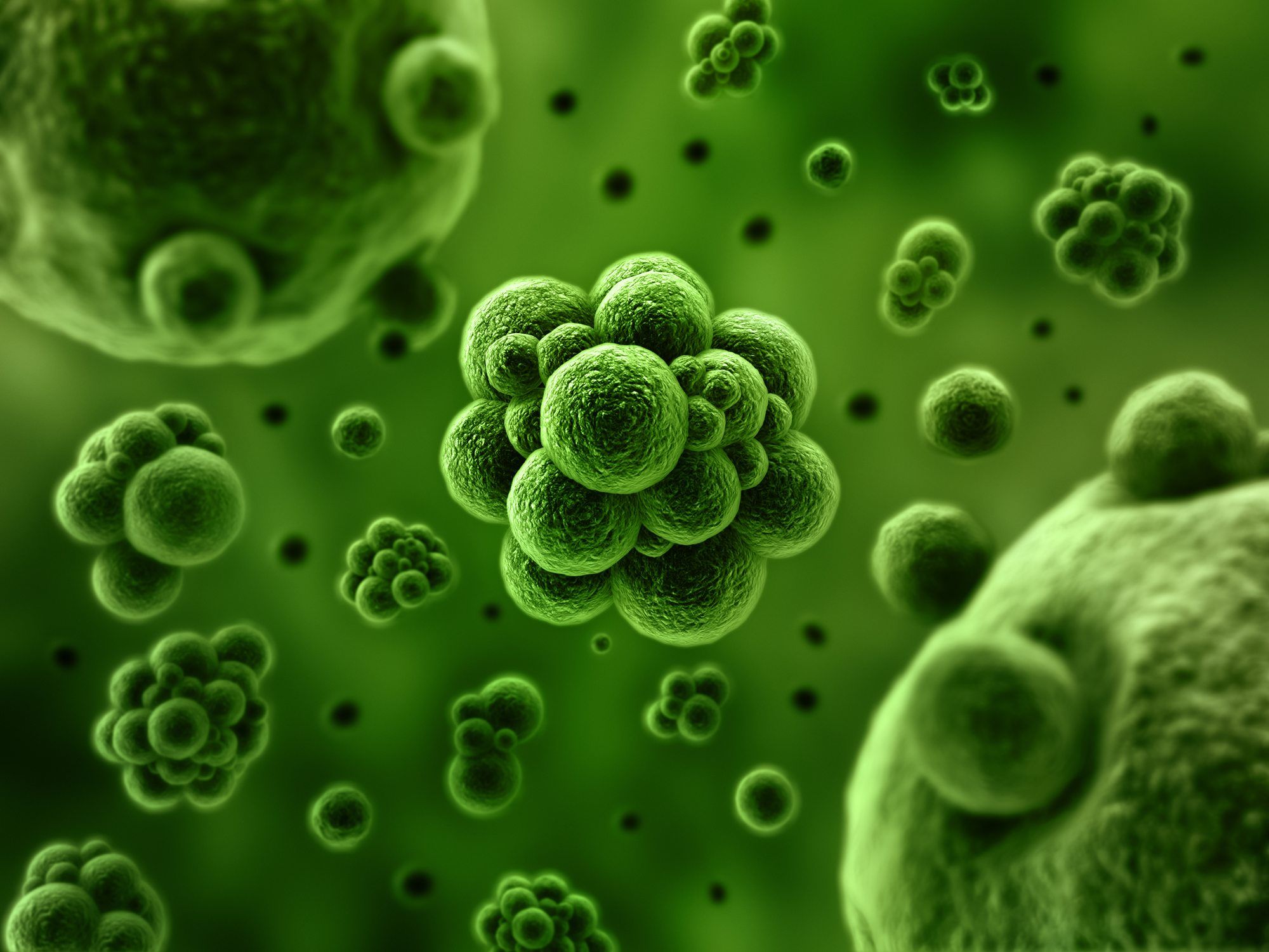 Necrotizing Fasciitis Caused by Fast Moving, Deadly Bacteria - Top ...