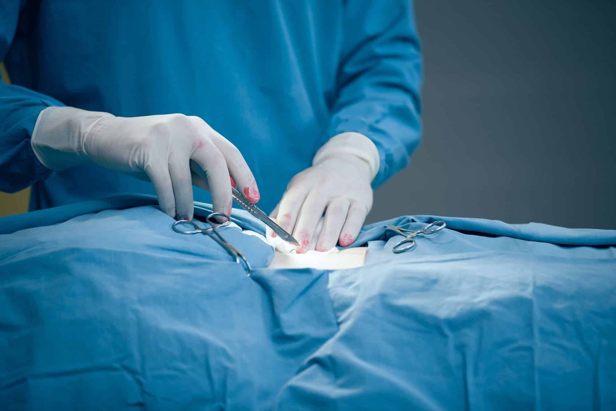 Ethicon Top Risk Surgical Stapler Revealed | Are You Eligible For ...